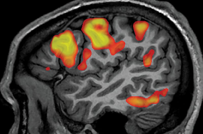 Scientists use AI To Decipher Words And Sentences From Brain Scans ...