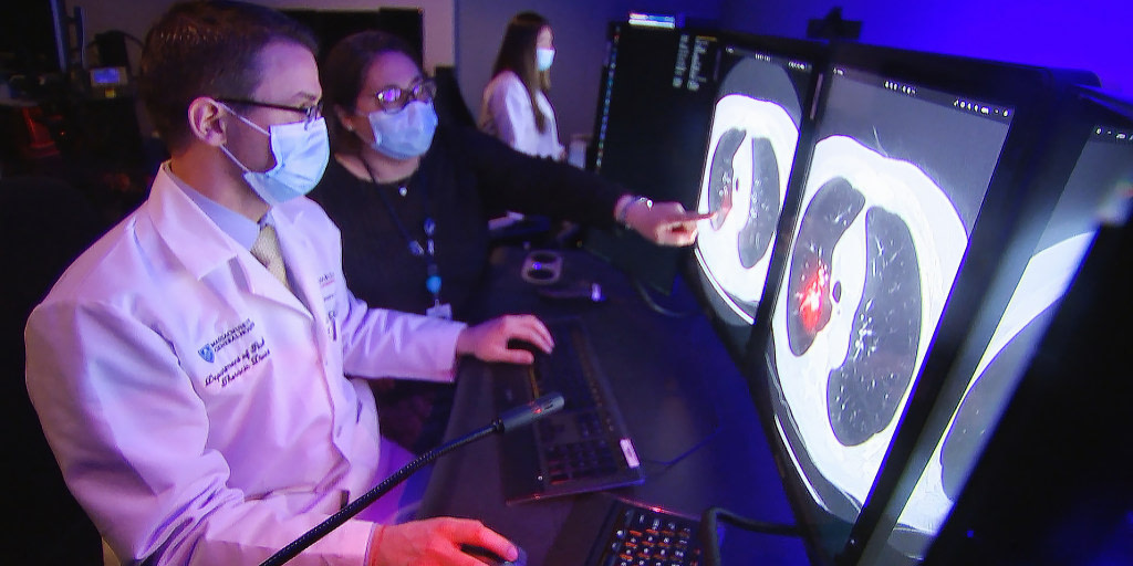 Promising New AI Can Detect Early Signs Of Lung Cancer That Doctors Can ...